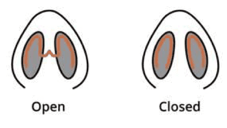 Nose job | Rhinoplasty Surgery | Open or Closed Rhinoplasty
